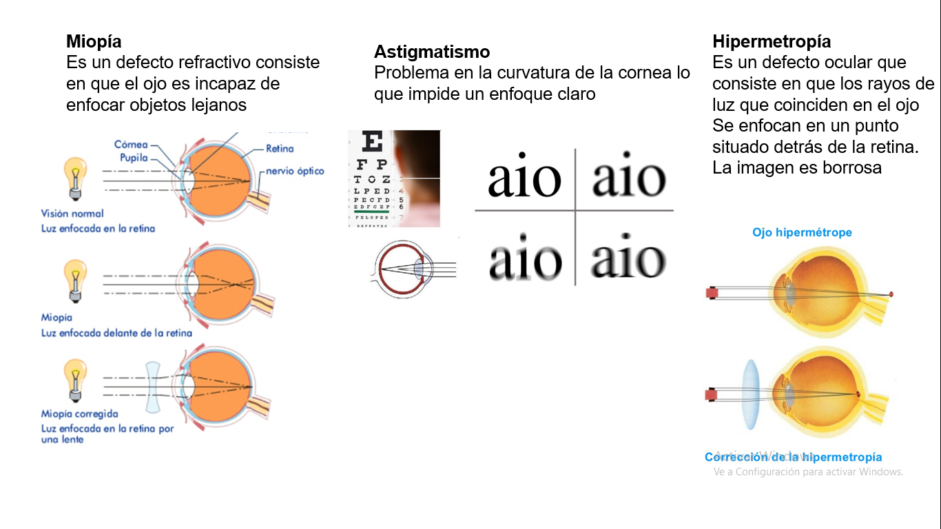acomodación visual y refracción