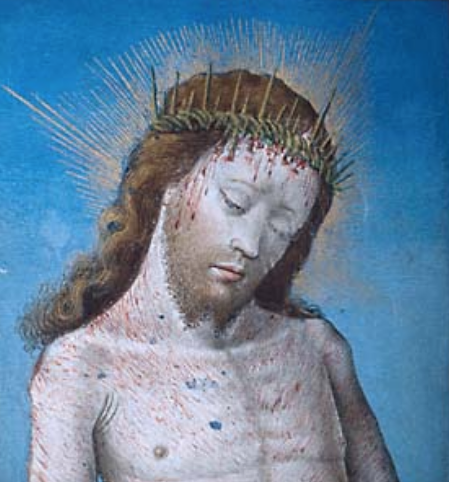 nunblog: Suffering and the Grace of Community