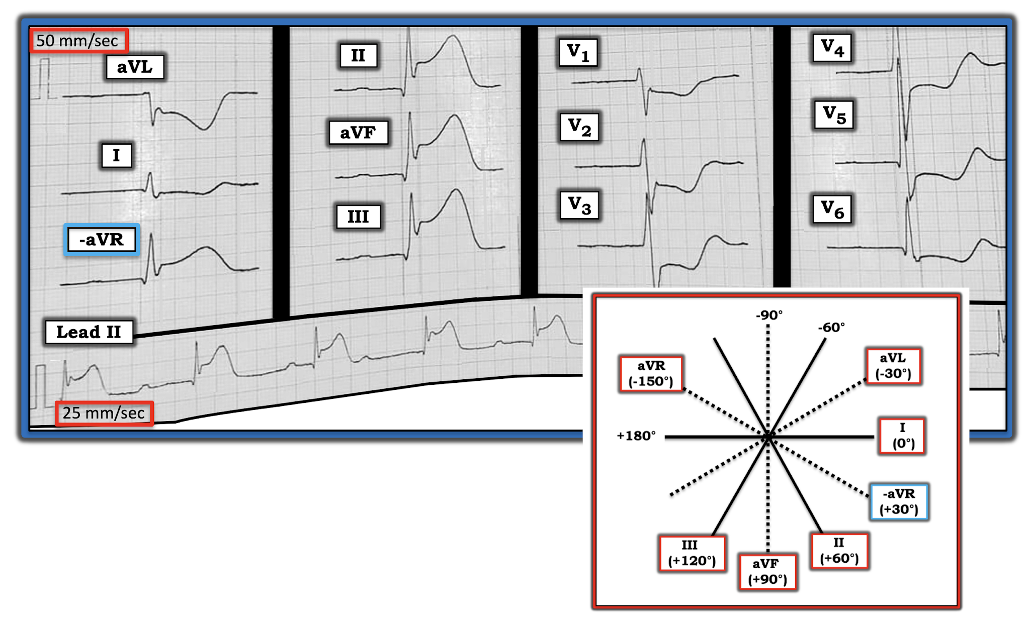 ECG Interpretation: Blog #215 — At Least 4 Notable Findings