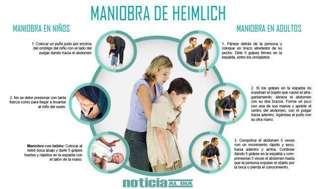 Maniobra de Heimlich