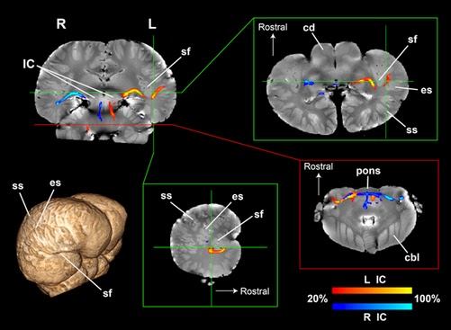 practiCal fMRI: the nuts & bolts: Functional MRI of dolphins?