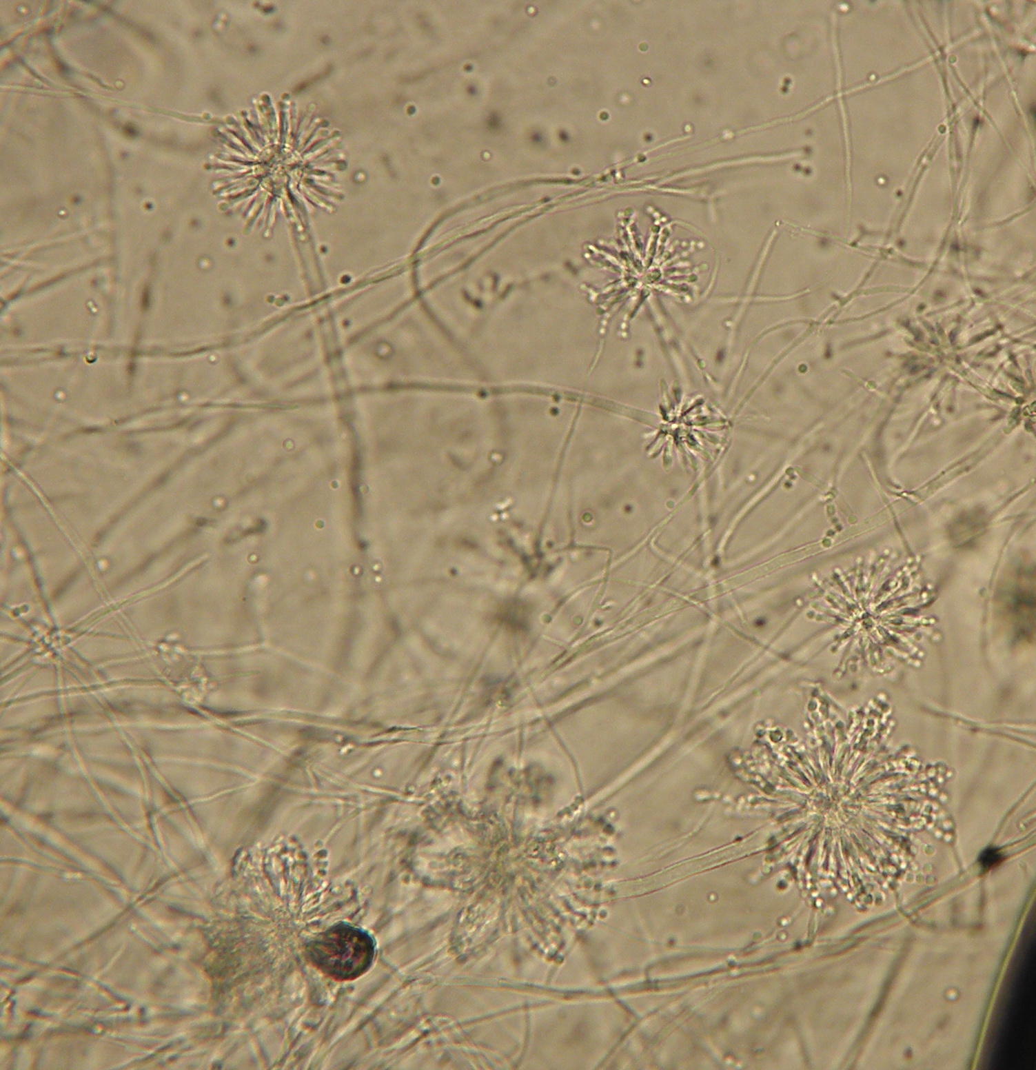 ATLAS MICOLOGIA: ASPERGILLUS CANDIDUS