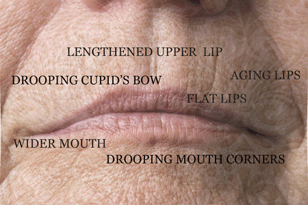 The Dermatology, Laser & Vein Center: August 2015