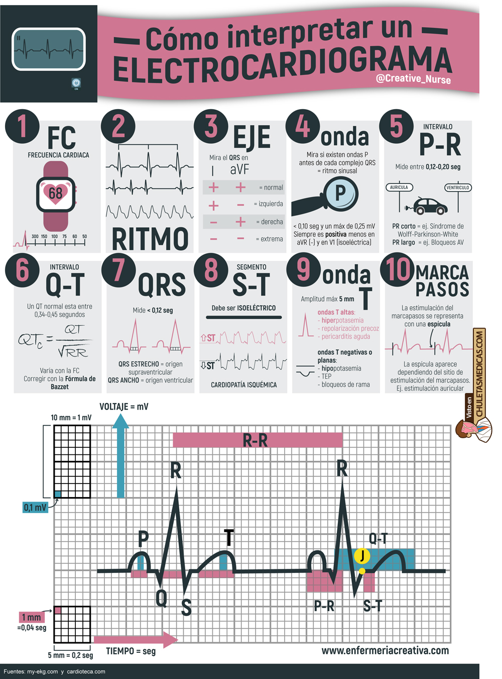 Las Sesiones De San Blas Hay Un Electrocardiograma Nuevo En El Centro las-sesiones-de-san-blas-hay-un-electrocardiograma-nuevo-en-el-centro