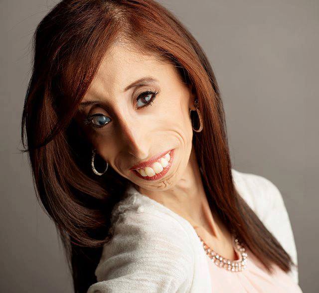 Lizzie Velasquez - Life ExamplesLife Examples