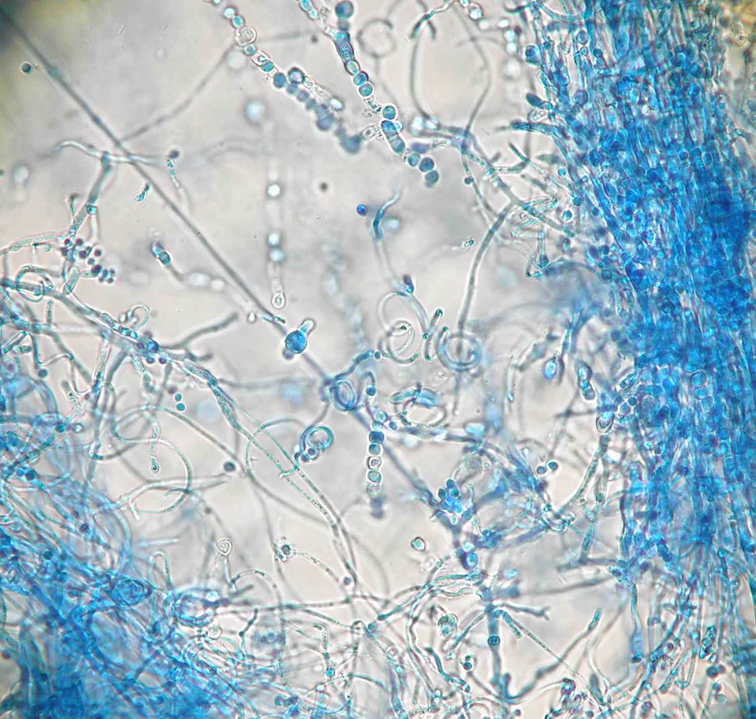 ATLAS MICOLOGIA: TRICHOPHYTON INTERDIGITALE