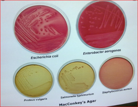 MacConkey Agar
