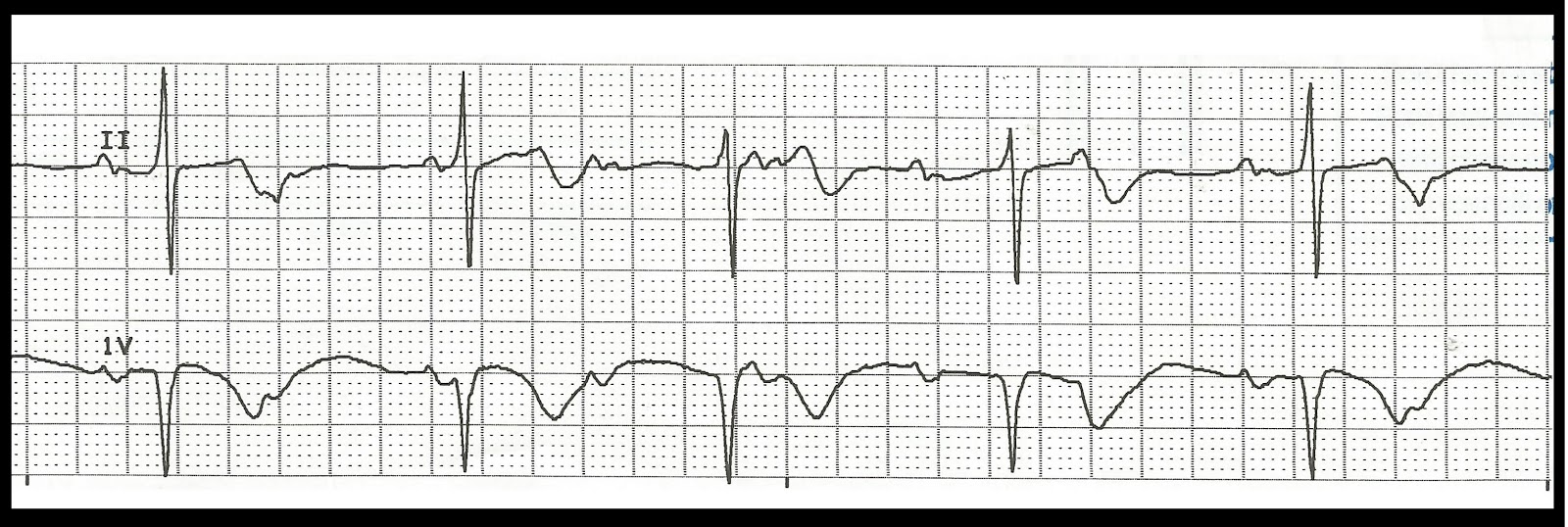 EKG Rhythm Strip Quiz 159