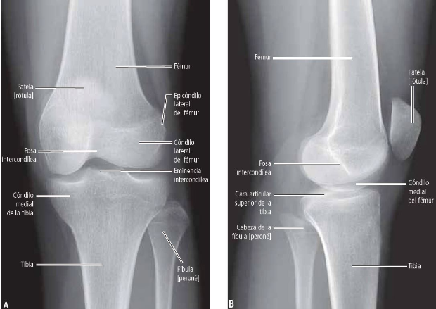 MMII-RODILLA-RX FRENTE Y PERFIL