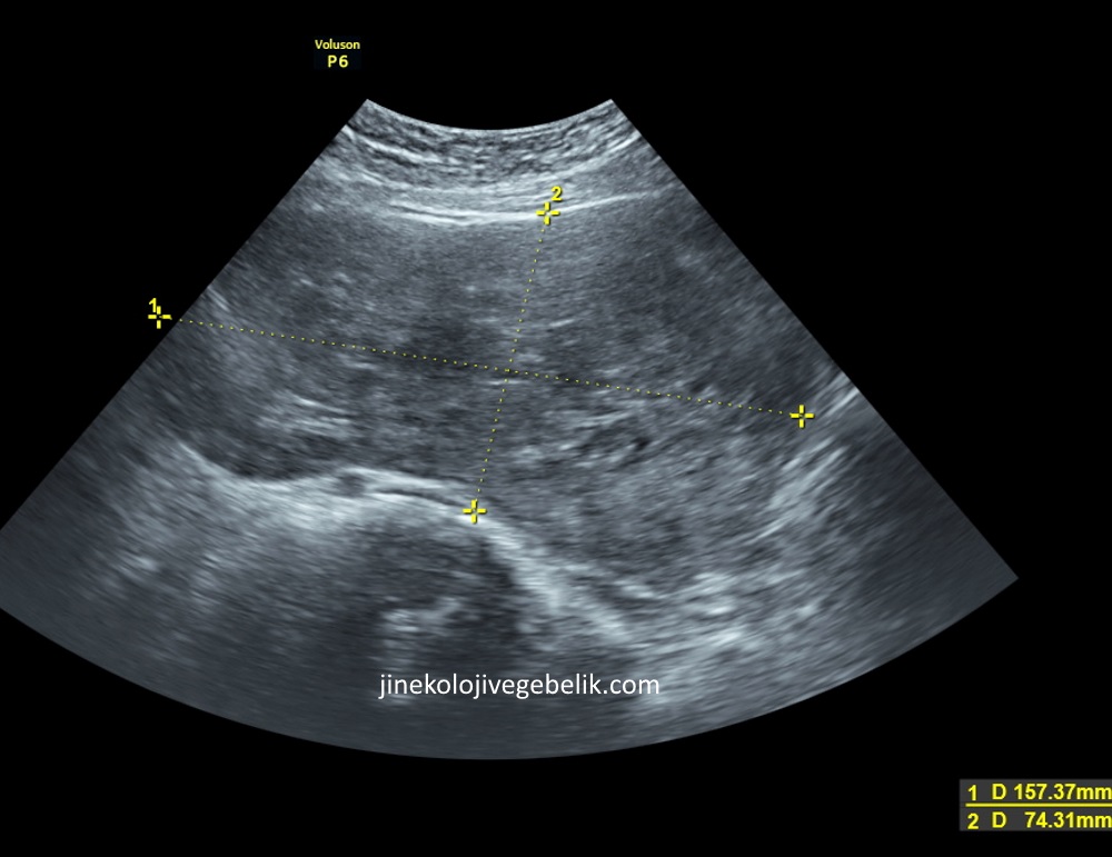 MİYOM GÖRÜNTÜLERİ