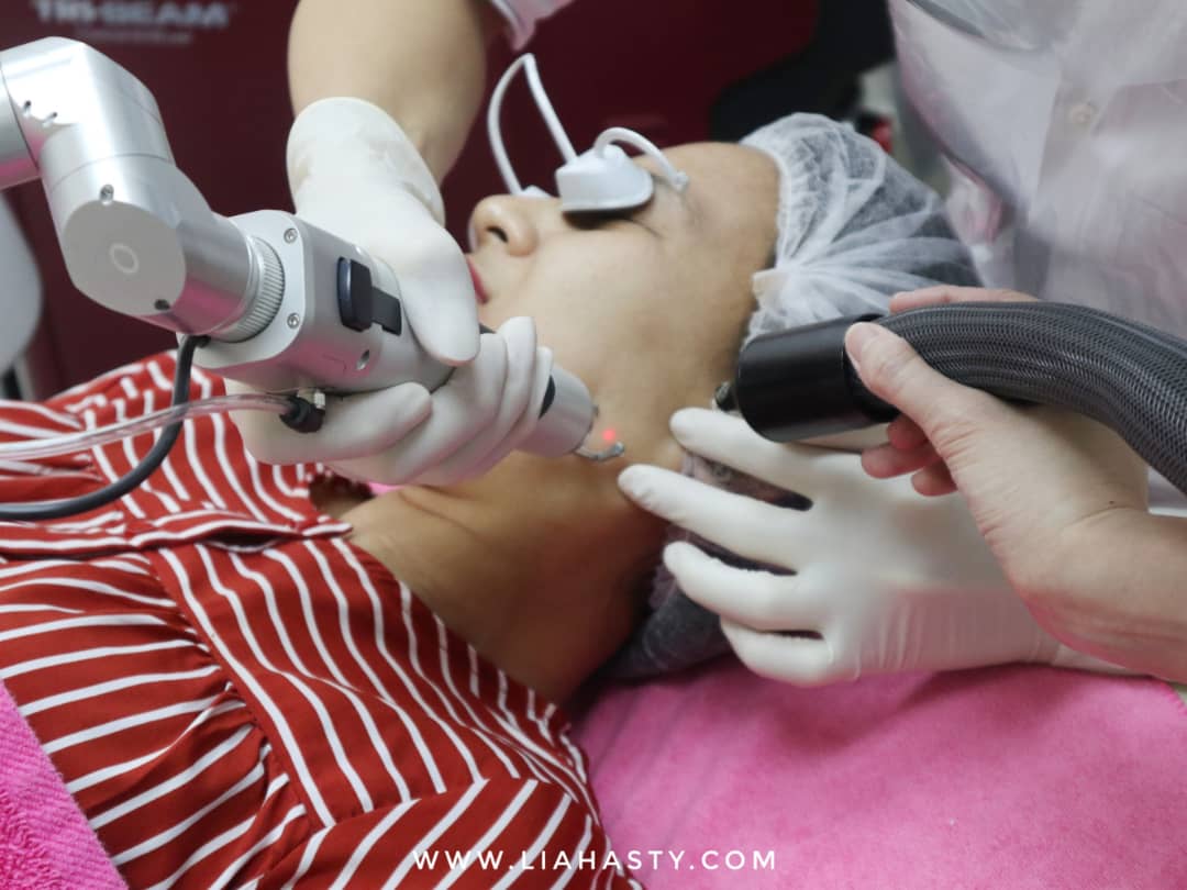 Rawatan Brightening & Open Pore di Klinik Pakar Dr Ko Juru - Lia Hasty