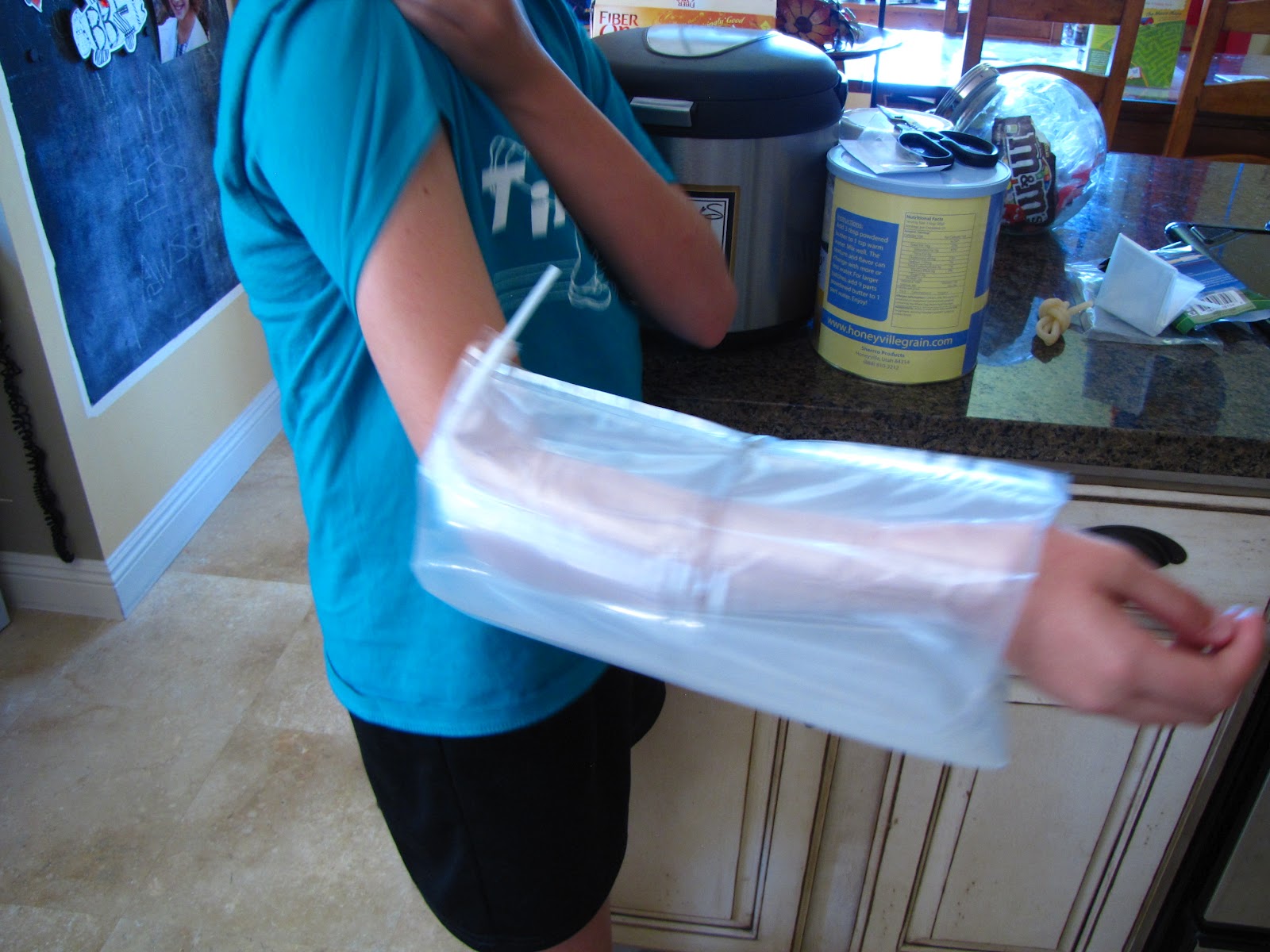 PREPARE TODAY: Emergency Splints