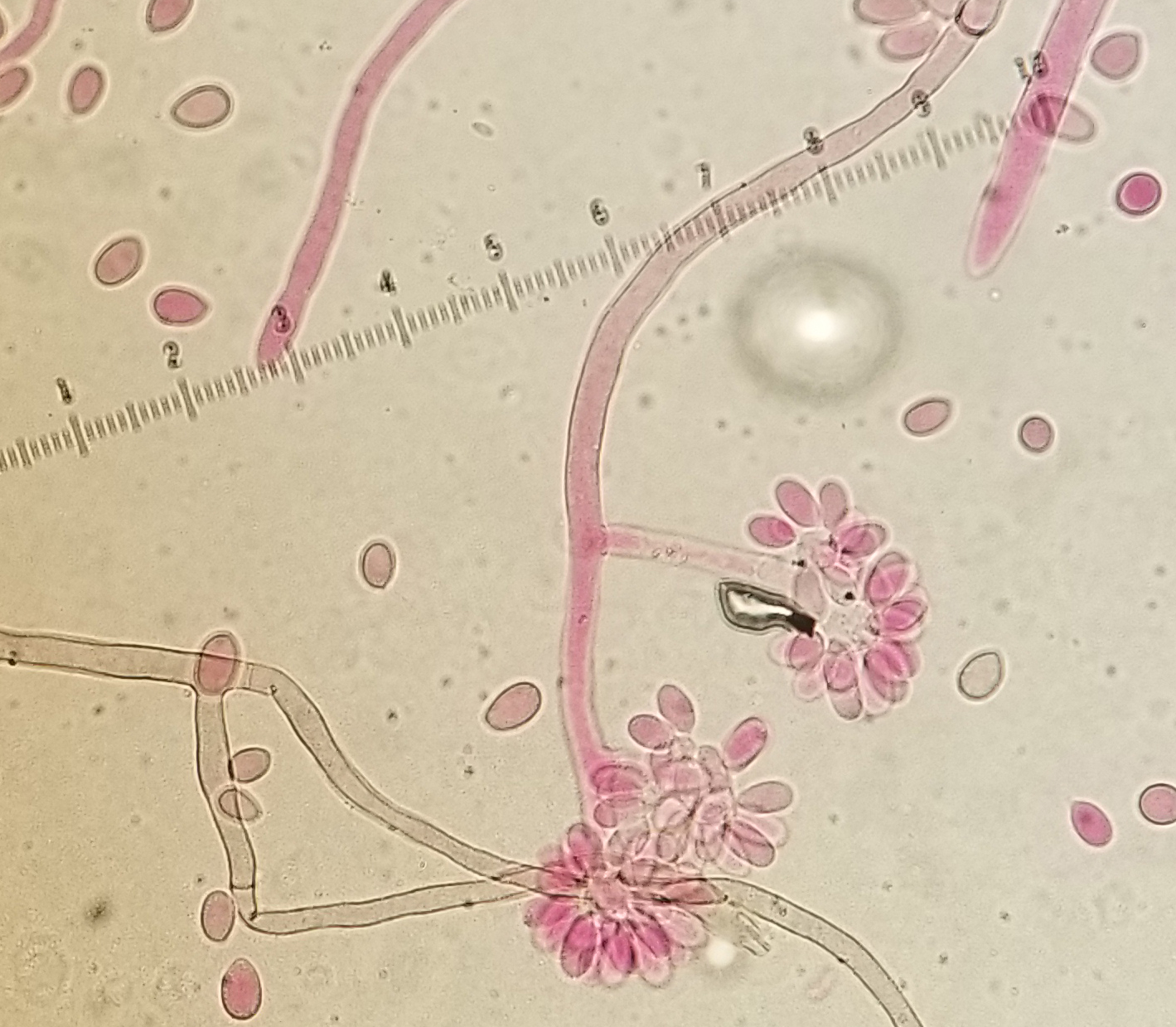 Sustainable Mycology: Blueberry Botrytis spp.