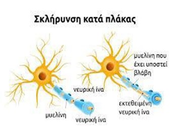 ΑΓΆΠΗ ΓΙΑ ΖΩH: ΣΚΛΗΡΥΝΣΗ ΚΑΤΑ ΠΛΑΚΑΣ ΚΑΙ ΥΓΕΙΑ