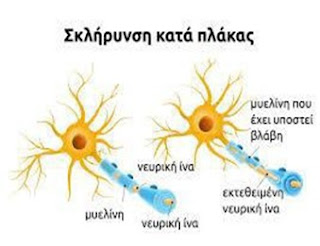 ΑΓΆΠΗ ΓΙΑ ΖΩH: ΣΚΛΗΡΥΝΣΗ ΚΑΤΑ ΠΛΑΚΑΣ ΚΑΙ ΥΓΕΙΑ