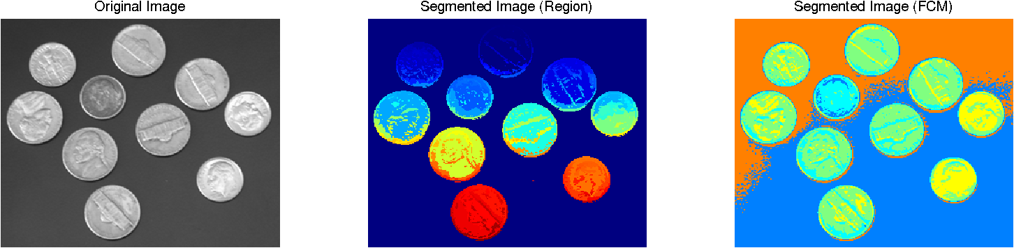 Taner Güngör Image Segmentation Region Growing Algorithm