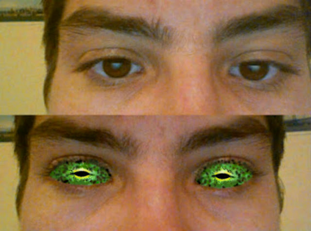 Today's News: Blind Man Is Given Sight With Frog Eyes - That's Right ...