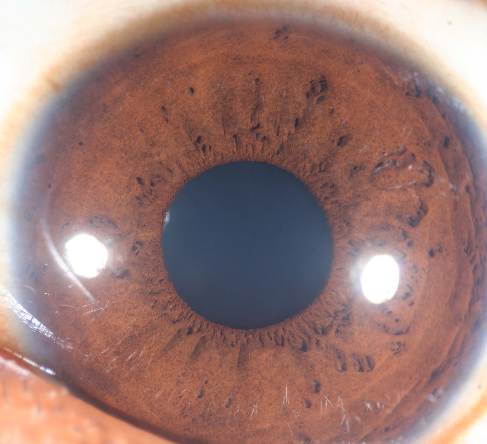Modern & Multidimensional Iridology: An Importance Iris Signs ! - Lx ...