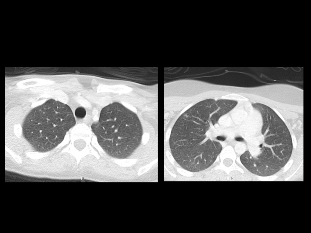 EL RINCÓN DE LA MEDICINA INTERNA. juanpedromacaluso@yahoo.com.ar ...