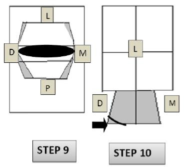 Permanent maxillary central incisors l tooth crown & root morphology ...
