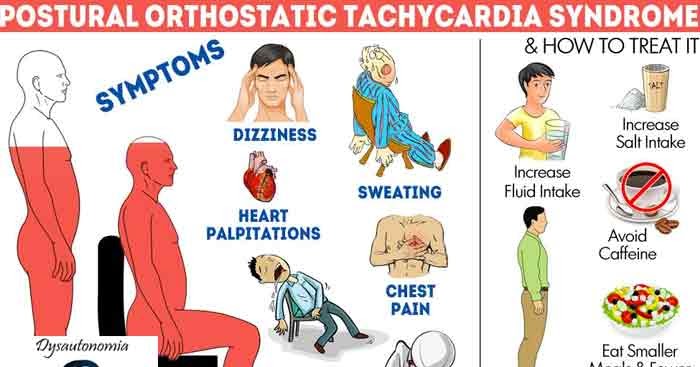 Postural orthostatic Tachycardia Syndrome (POTS): Needs Rehabilitation ...