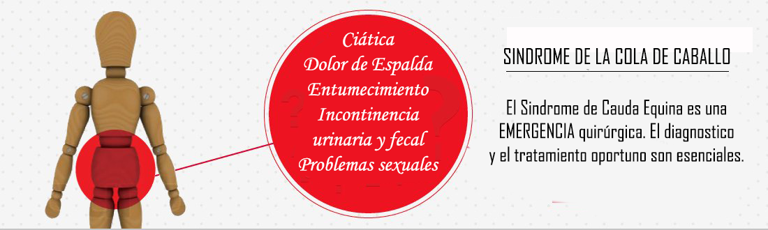 DrColumna: CAUDA EQUINA - SINDROME DE LA COLA DE CABALLO