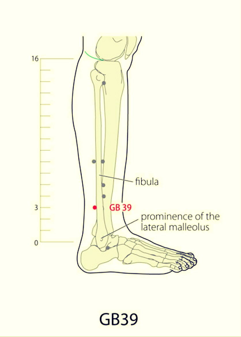SaroEpic Acupuncture : 2016