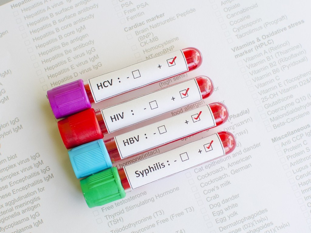 Timely screening of donated blood holds the key to curb Transfusion ...