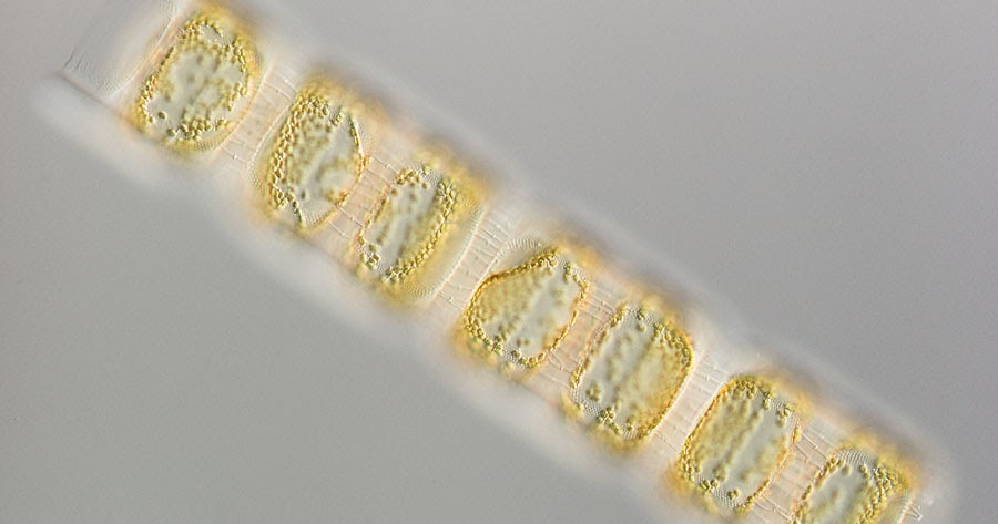 明石・神戸の虫 ときどきプランクトン2: ステファノピクシスの一種（Stephanopyxis sp.）