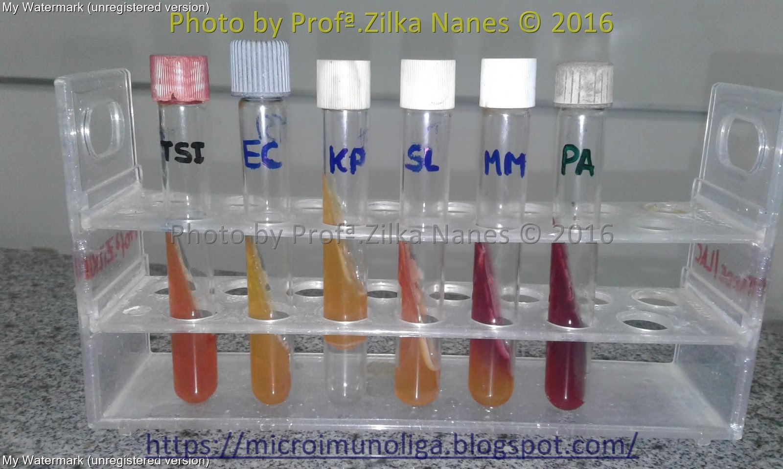 14. IDENTIFICAÇÃO DE ENTEROBACTÉRIAS