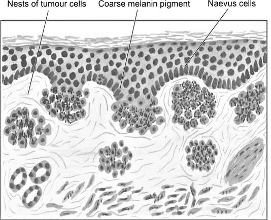 cellular injury ( part 3) l General pathology revision for dental ...
