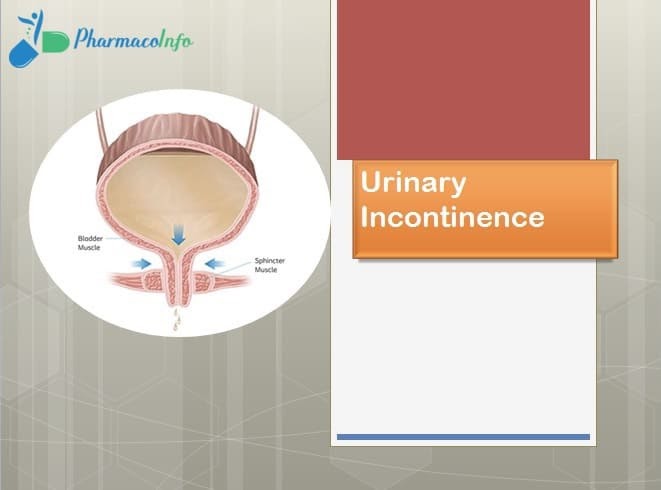 Urinary incontinence definition, classification, risk factors ...
