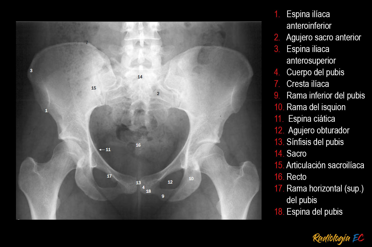 Radiografia de Pelvis