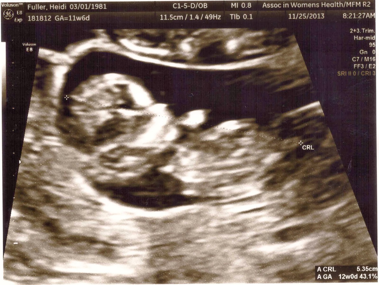 So Much More...: 11 weeks & 4 days