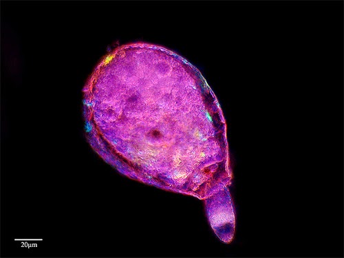 Mi Blog De Biologia: Los Protozoarios.