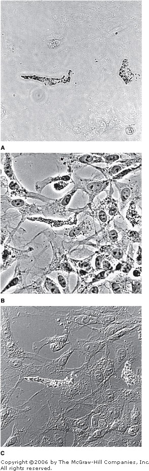 De Histology: Phase-Contrast Microscopy & Differential Interference ...