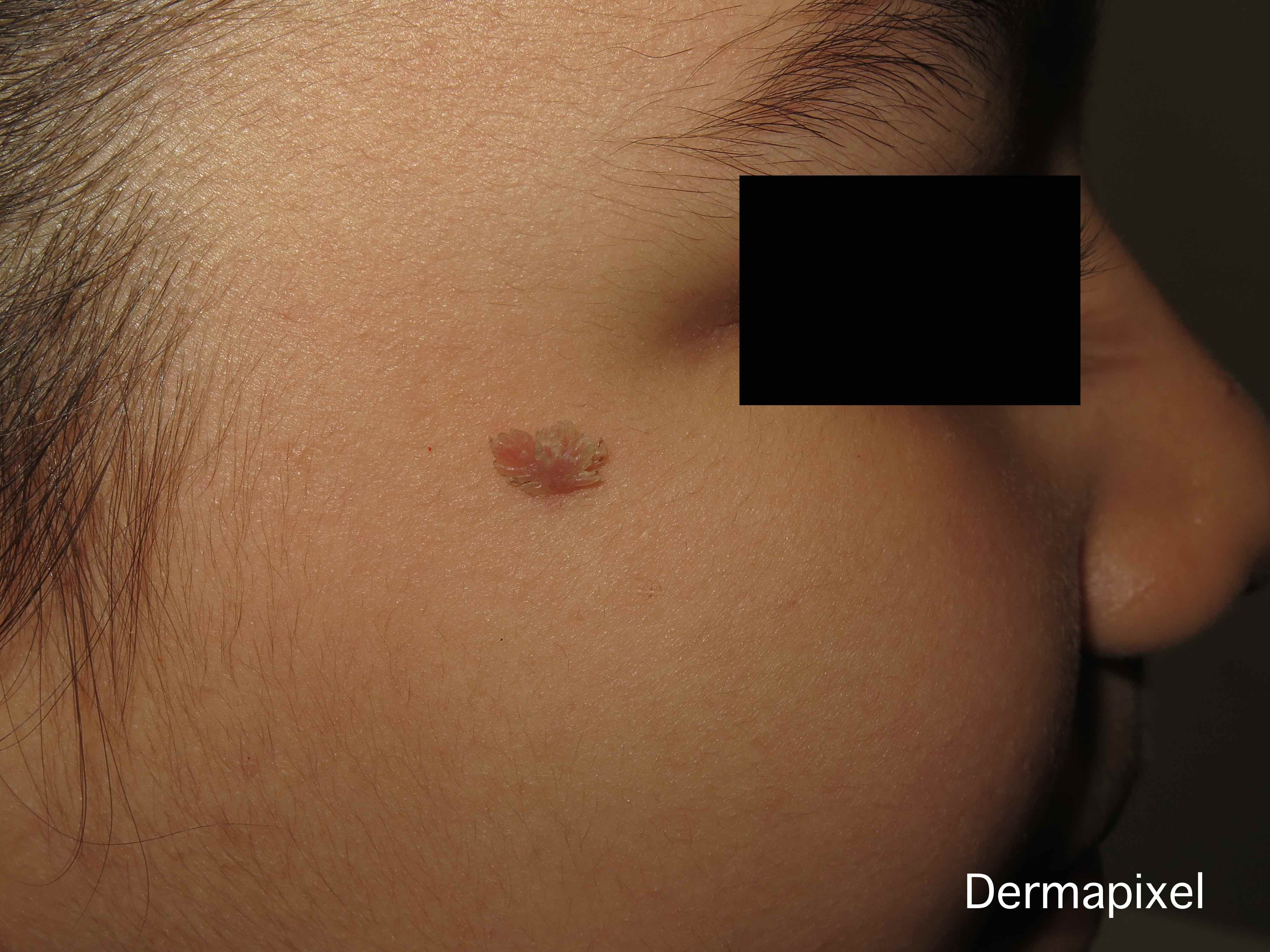 Dermapixel: abril 2021