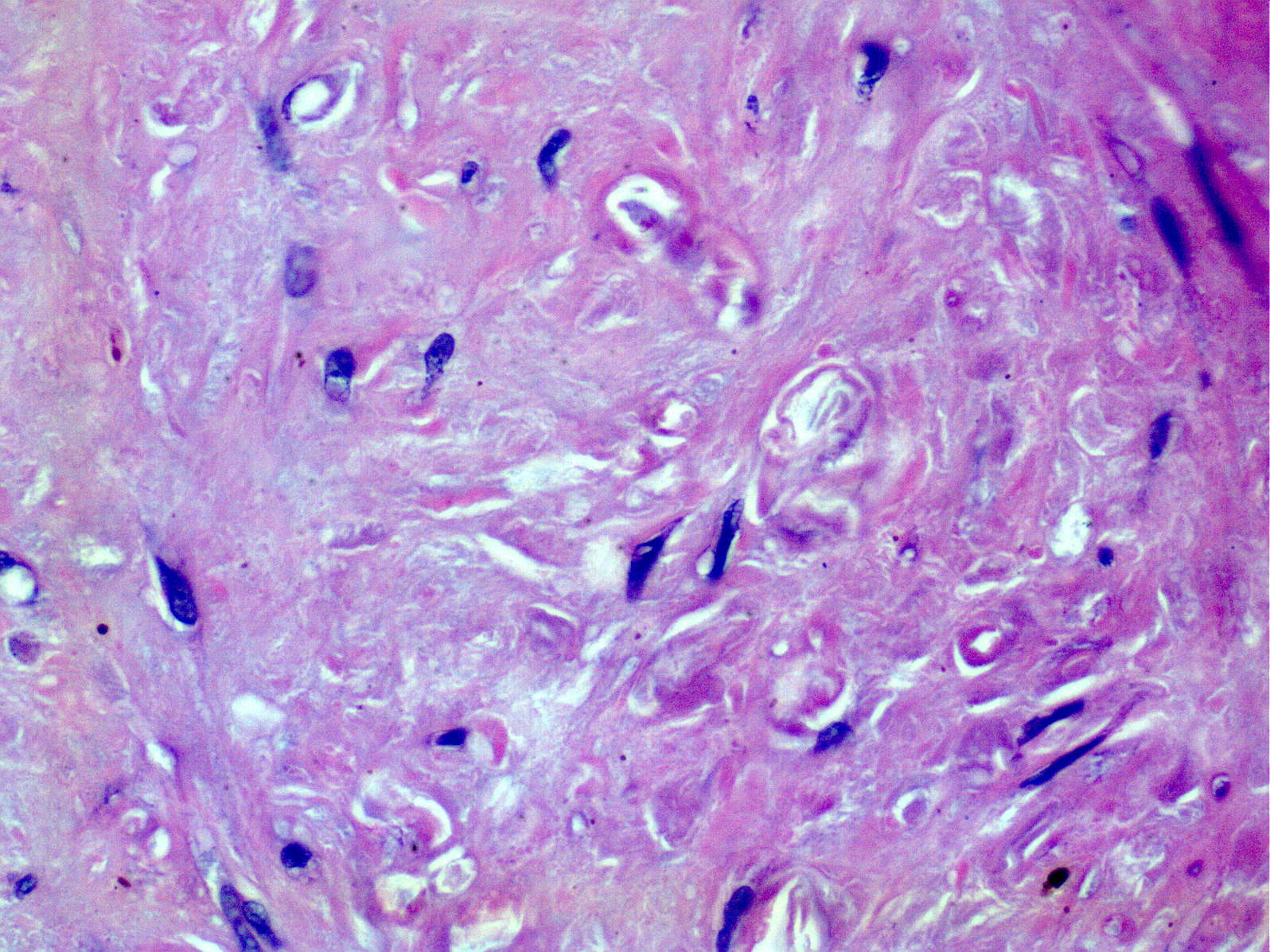 Histopatologando - Atlas do HCFMRP-USP: Âmnio nodoso