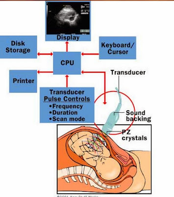 BLOG TEKNIK & VOKASI: Prinsip Kerja Mesin Ultrasonography (USG) Doppler