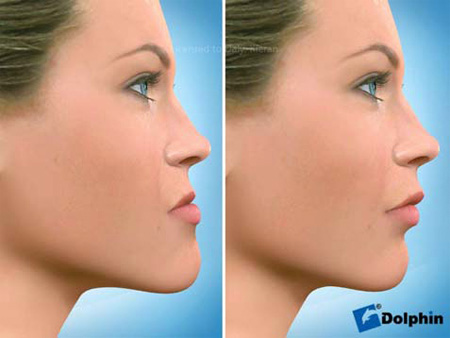 Stadsklev Dental Blog: The First Steps in Orthodontic Treatment