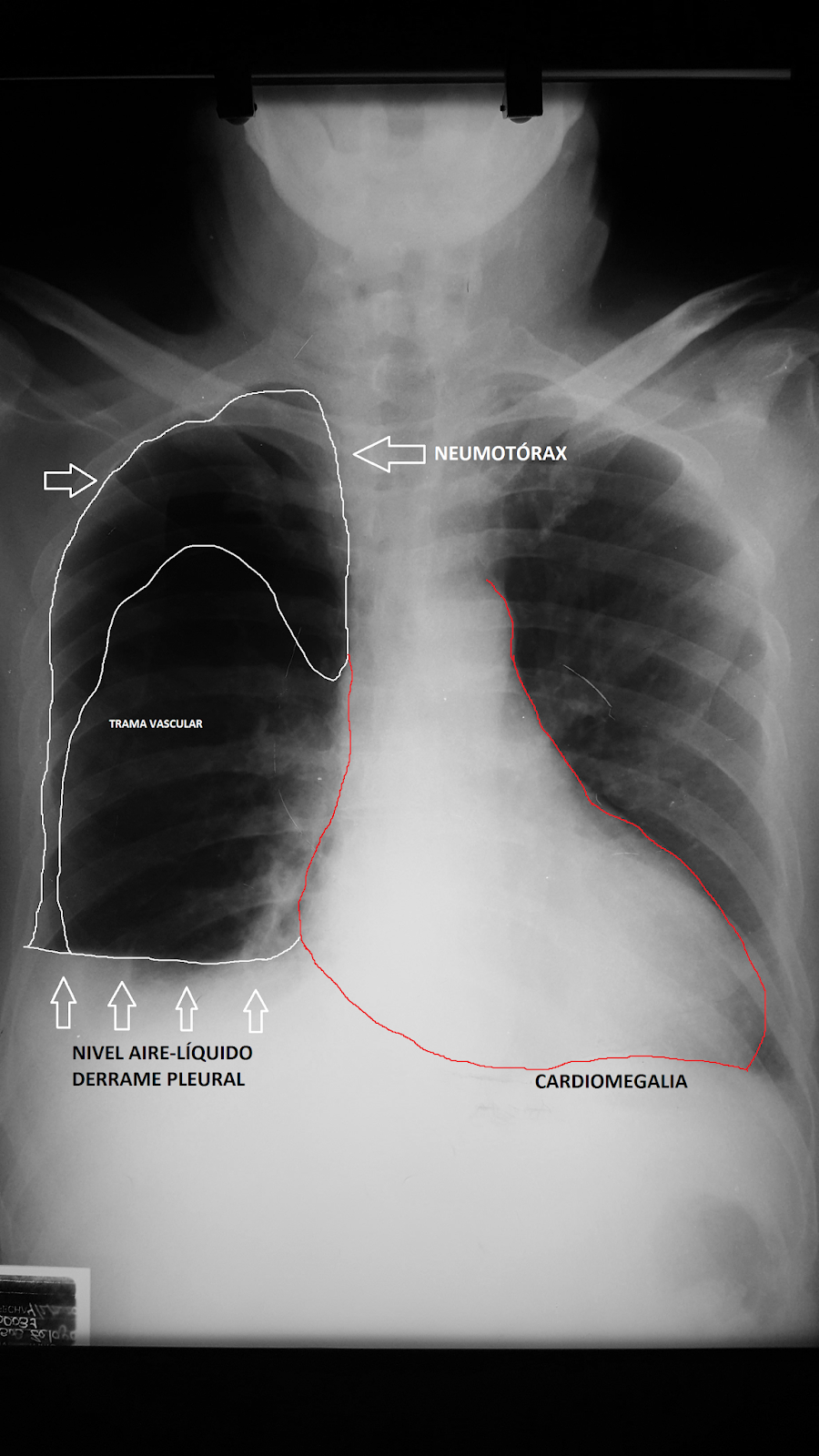 Radiografía de tórax 001