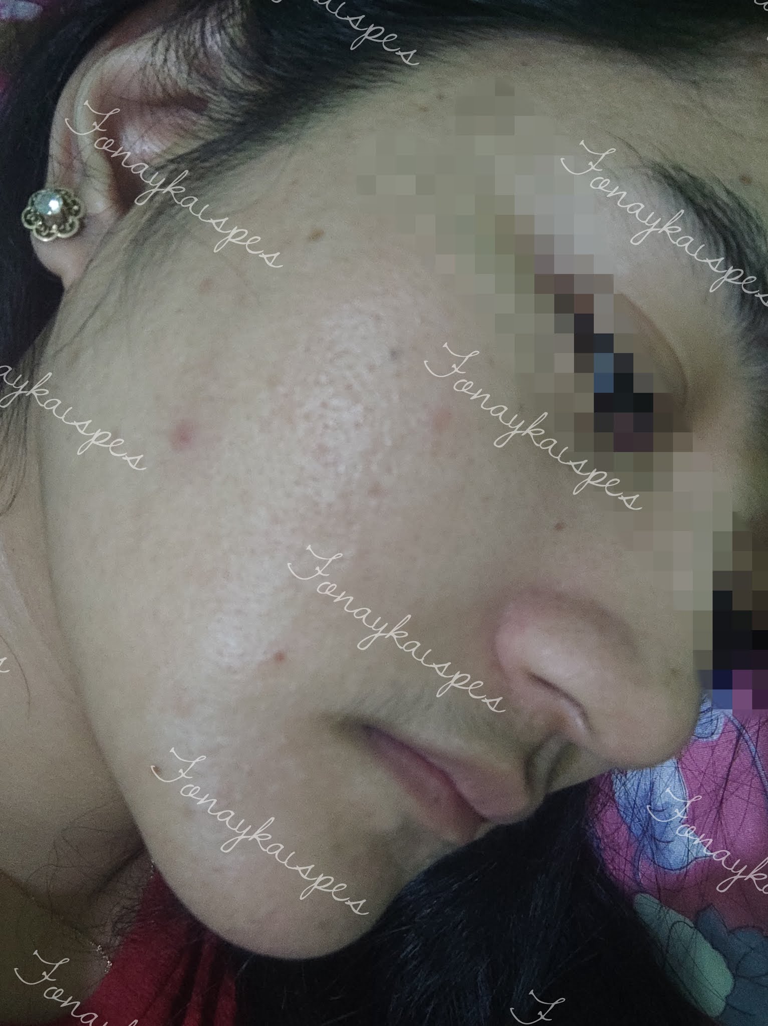 Lionesse Gem Skin Care White Pearl Facial Peeling Review ...