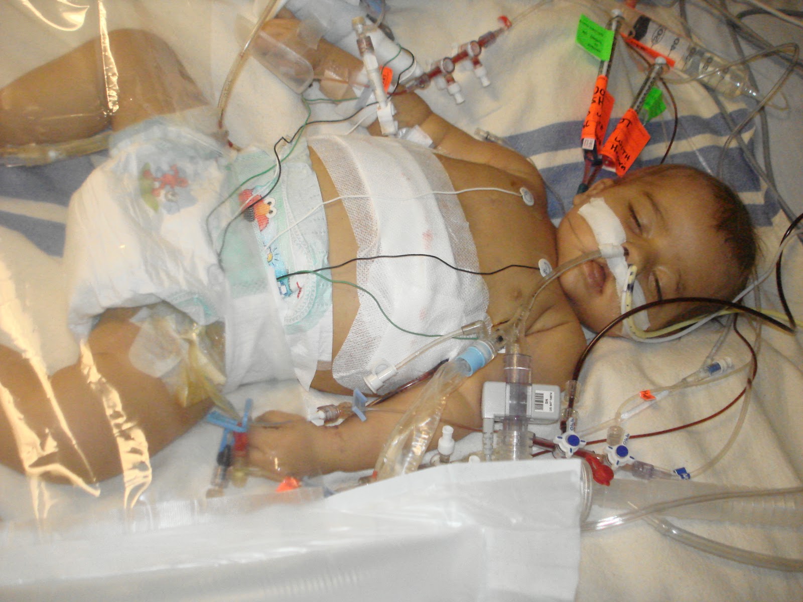 Daphne Anne's Journey: Infection
