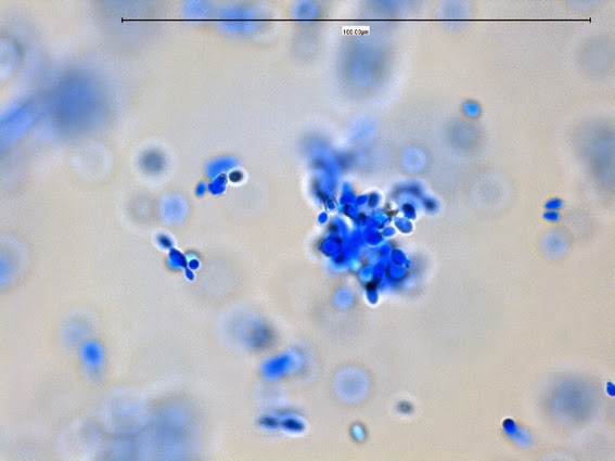 Fun With Microbiology (What's Buggin' You?): Sporothrix schenckii ...