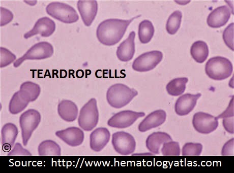 Lab Atlas: Teardrop Cells