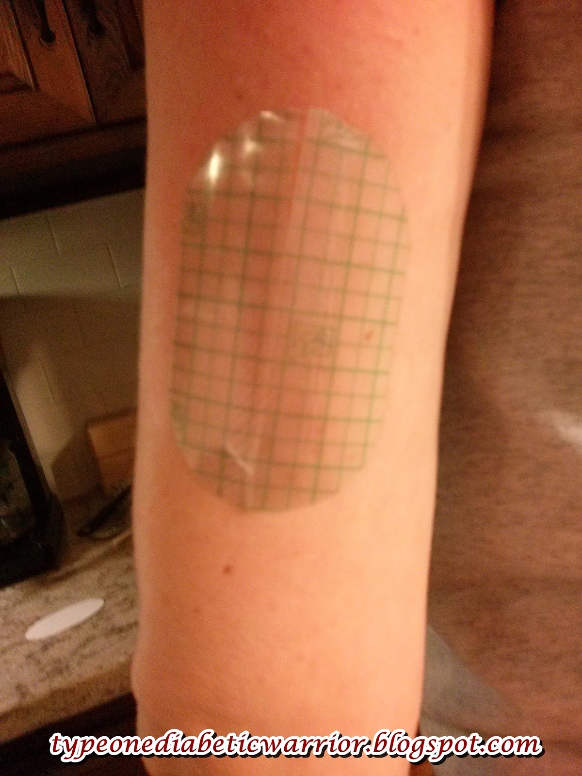 I am a Type 1 Diabetic Warrior: Diabetic Warrior Dexcom and Opsite ...