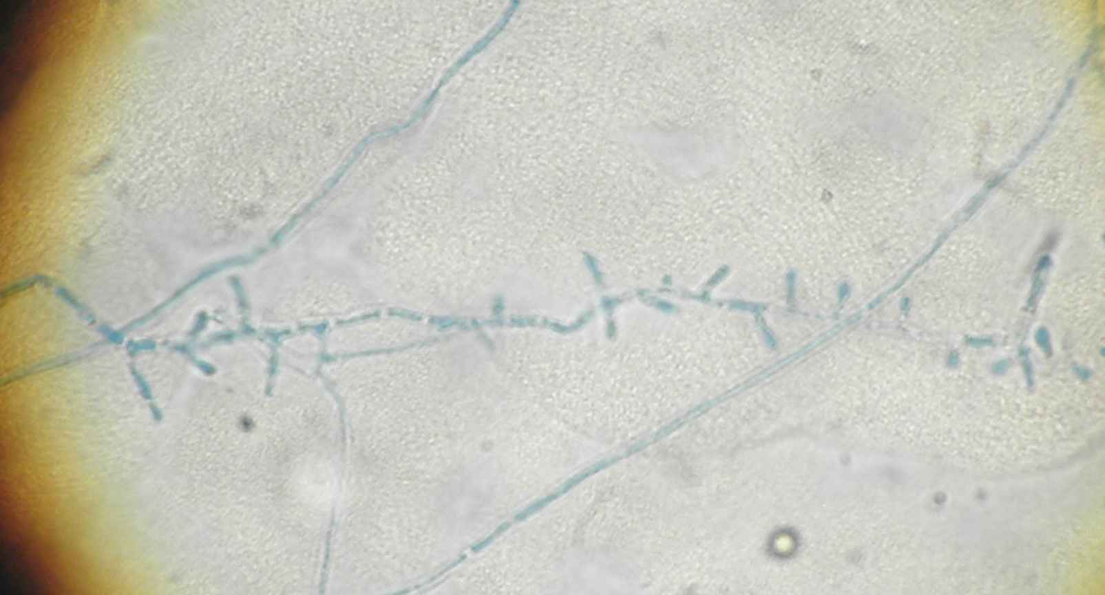 ATLAS MICOLOGIA: TRICHOPHYTON SOUDANENSE (II)
