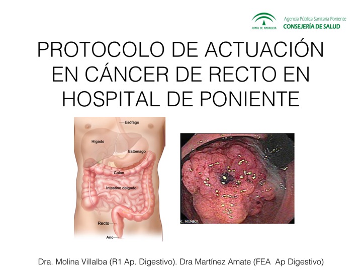 Protocolo de actuación en el cáncer de recto. Hospital de Poniente ...