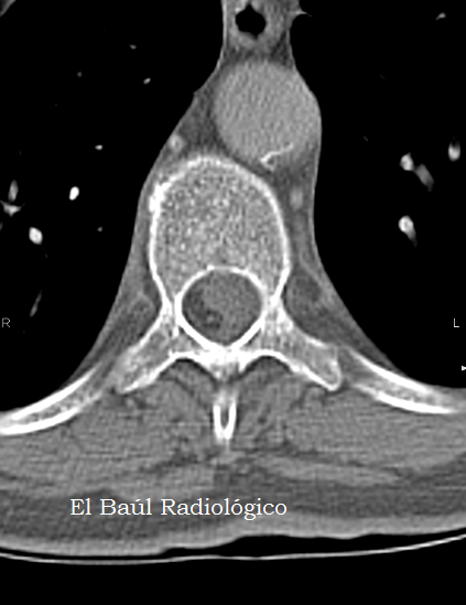 El Baúl Radiológico: TOMOGRAFÍA COMPUTARIZADA Y TRM: LOS OJOS QUE TODO ...