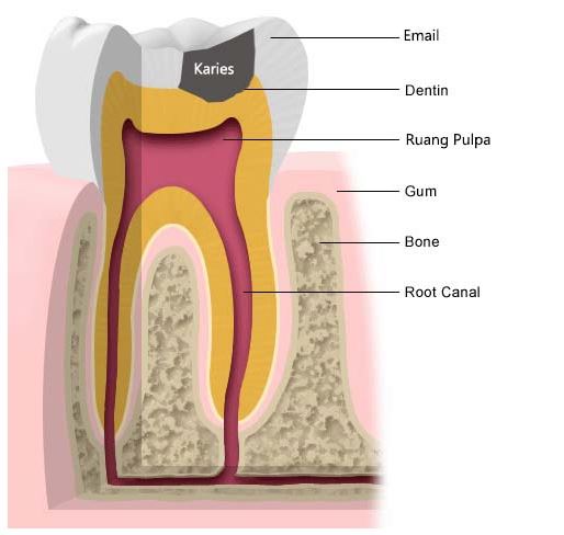 Toothache and knowing the depth of the hole on the gear - Dental Care